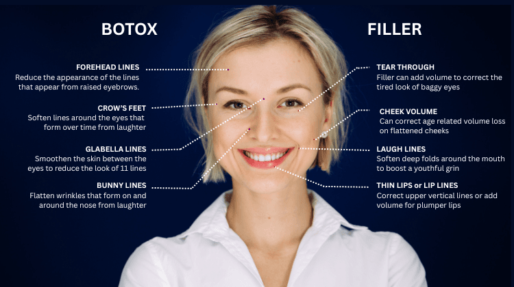 Difference Between Botox and Fillers | Which is Best for You